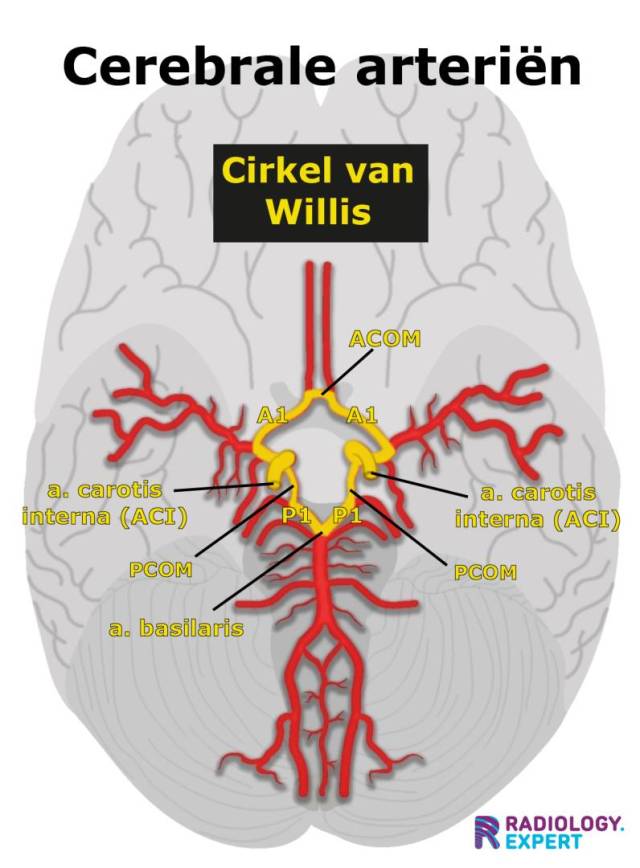 Interventieradiologie - De CVA Patient